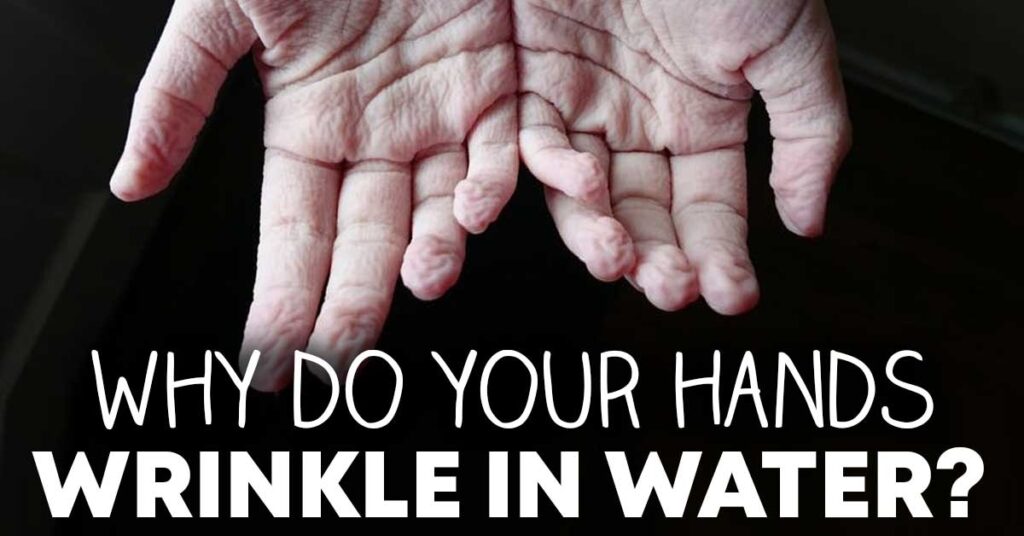 Why Do Your Hands Wrinkle In Water? - Integracare Clinic